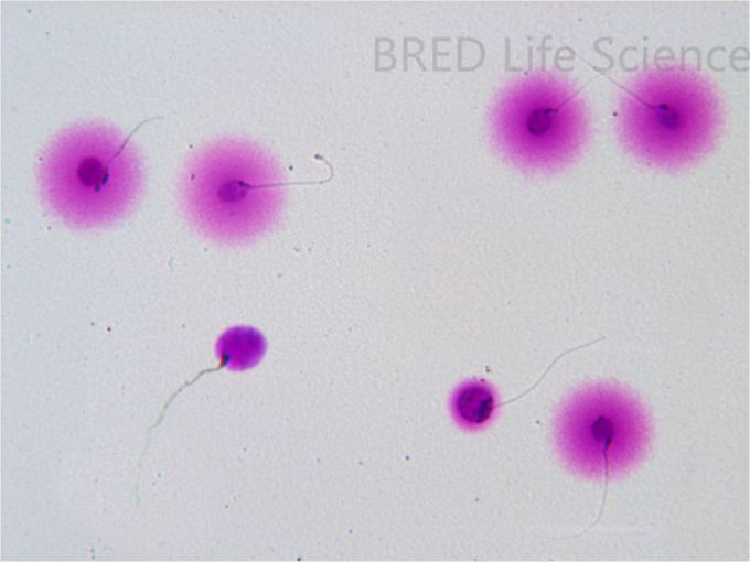 40 Tests / Kit SCD Method Sperm DNA Fragmentation Test Kit Wright ...