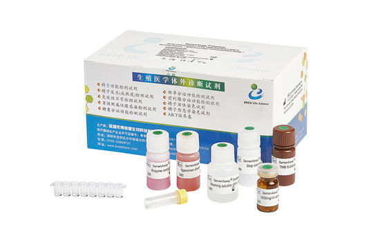 Quality Male Fertility Test Kit & Sperm DNA Fragmentation Test Kit ...