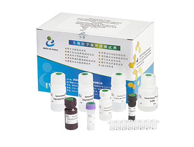 High Accuracy Male Fertility Test Kit 40T/Kit For Male Infertility ...